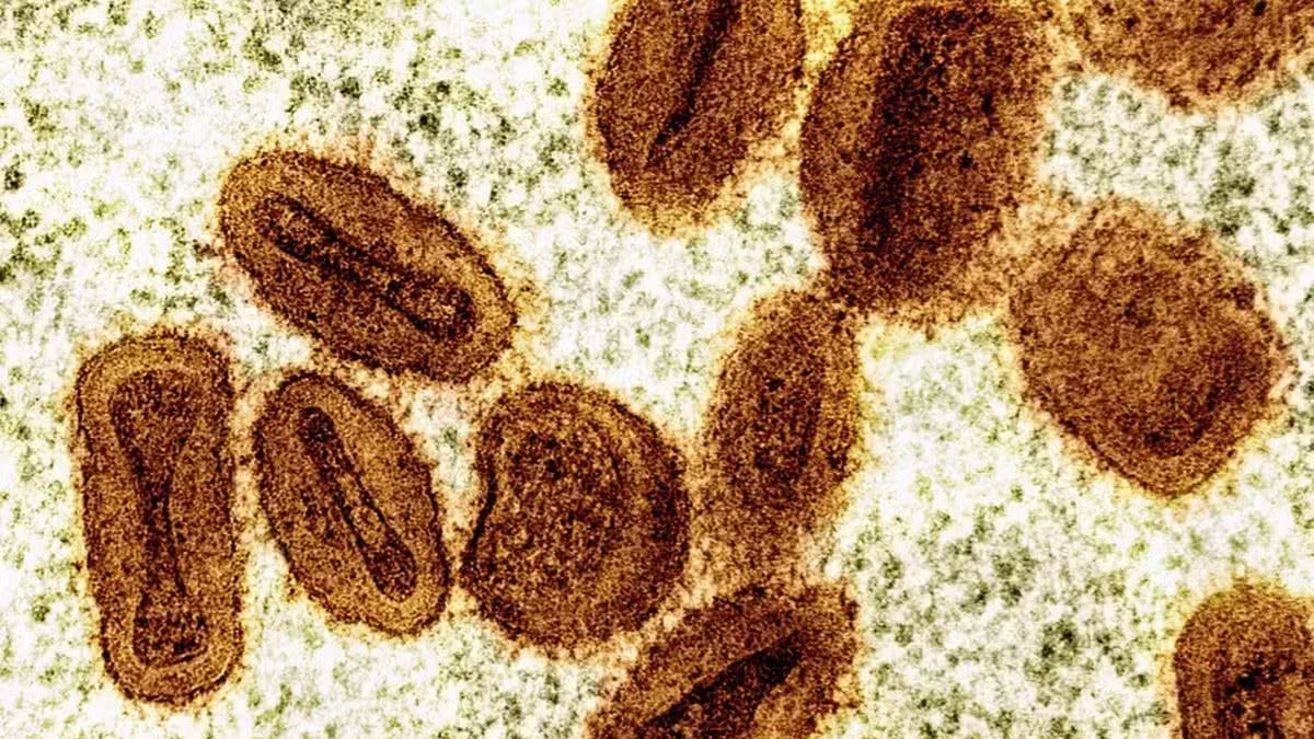 SP confirma primeiro caso de nova cepa de Mpox no Brasil