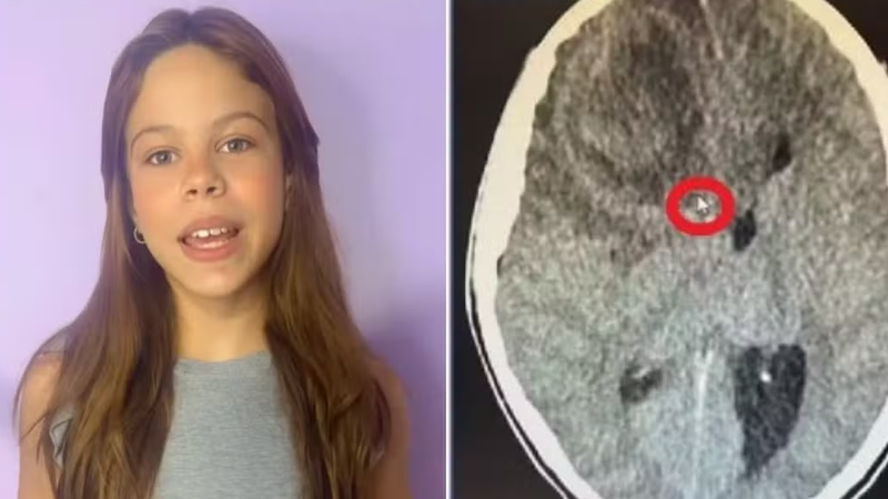 Morte de atriz mirim ex-SBT e Netflix: laudo médico revela a causa