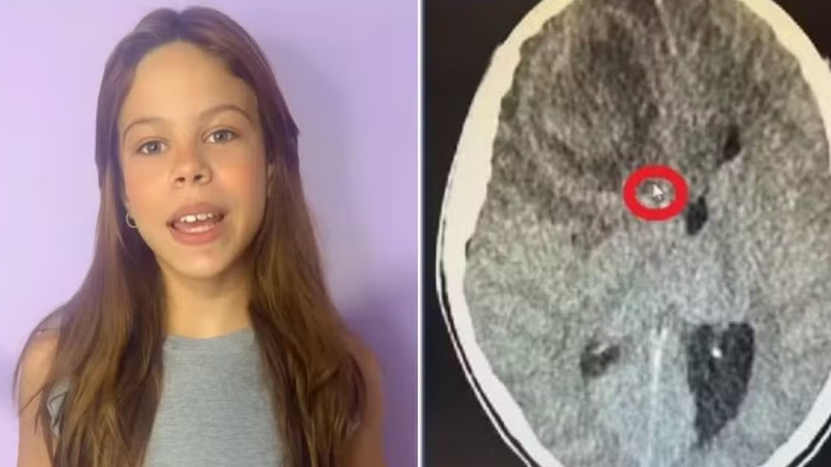 Morte de atriz mirim ex-SBT e Netflix: laudo médico revela a causa