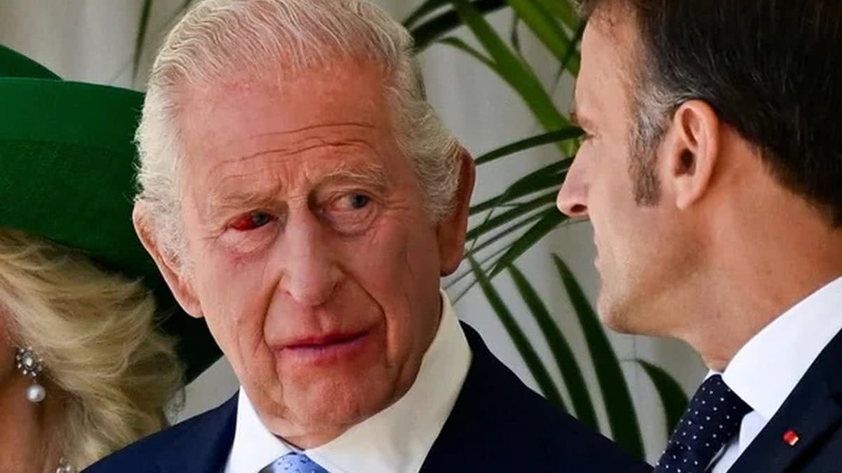Olho vermelho de Rei Charles III rouba a cena em cerimônia; Palácio de ...