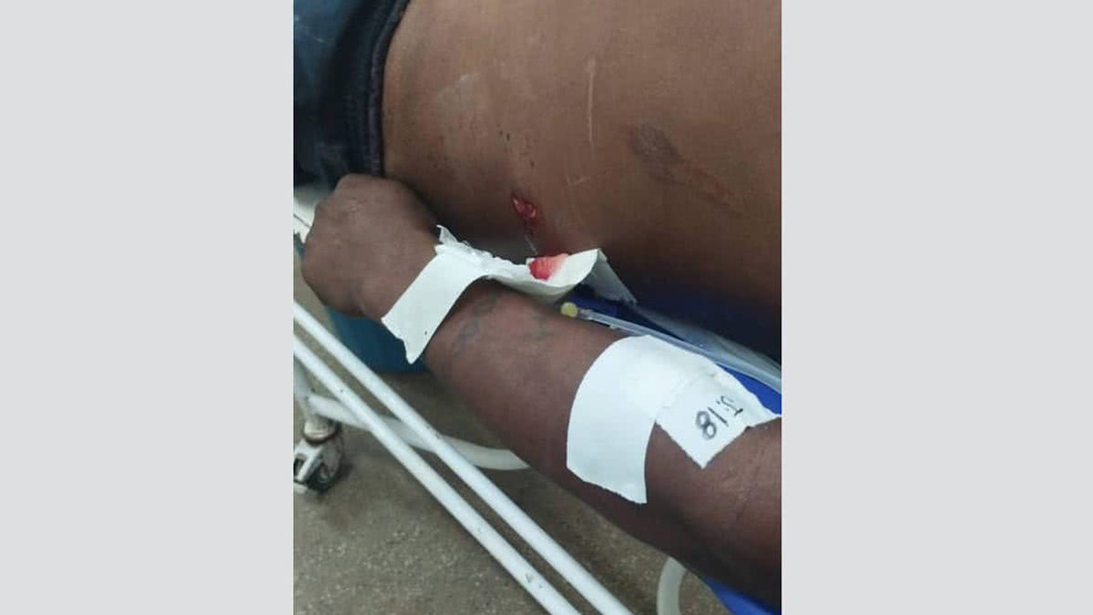 Homem morre após flechada e outro fica ferido no sul do Amazonas