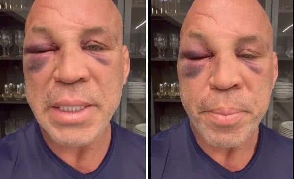 Wanderlei Silva revela perda de memória e desabafa após confusão em ...