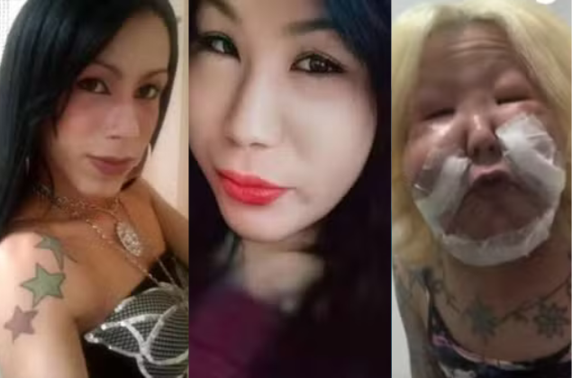 Quem é 'Juju do Pix', influencer que fez cirurgia para tirar óleo do rosto