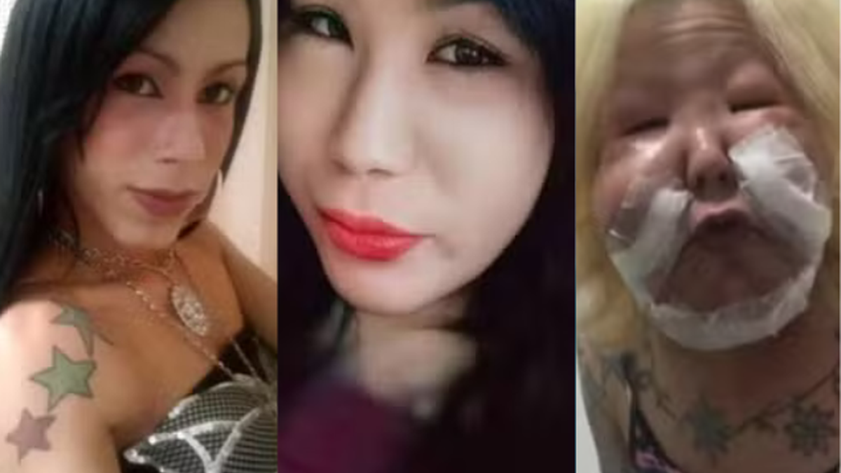 Quem é 'Juju do Pix', influencer que fez cirurgia para tirar óleo do rosto