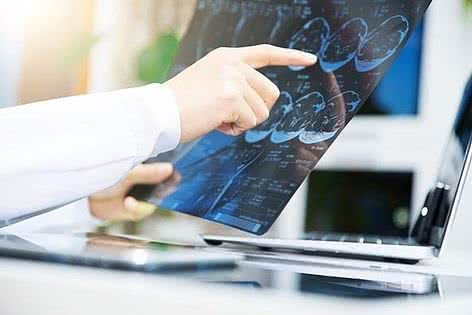 Estudo analisa caso raro de isquemia medular em recém-nascido