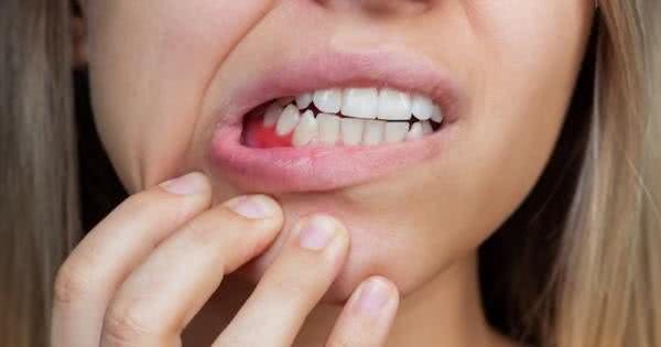 Esteja atento à cor das suas gengivas para manter a saúde da boca; veja